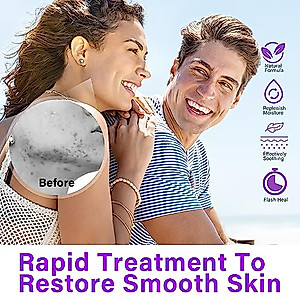 Azelaic Acid 12% Facial Serum,Skin Brightening Hyaluronic Acid and Niacinamide, Redness Relief, Fade and Repair Dark Spots