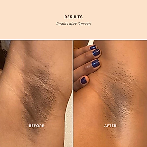 Bushbalm Dark Spot Exfoliating Scrub - Natural Body Scrub Exfoliant to Hydrated, Soften and Enhance Glow in Skin - Bermuda 236 ml