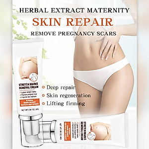 Stretch Mark Cream, Scar Cream Removal Cream Scars Essence Stretch Mark Repair Cream Stretch Scars Remove Acne Cream Stretch Mark Treatment Maternity Repair
