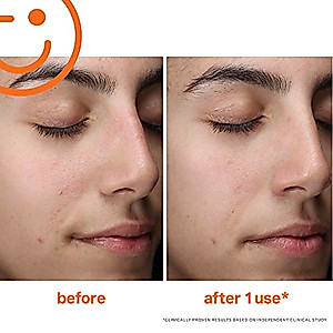 Kate Somerville ExfoliKate Cleanser – Daily Exfoliating Foaming Face Wash – Clinically Formulated Glycolic Acid and Lactic Acid Gentle Facial Scrub, 1.7 Fl Oz