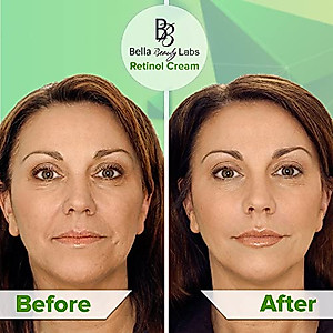 Retinol Moisturizer Anti Aging Cream for Face and Eye Area - With Hyaluronic Acid - 2.5% Active Retinol - Vitamin E - Reduce Appearance of Wrinkles and Fine lines - Best Day and Night Face Cream