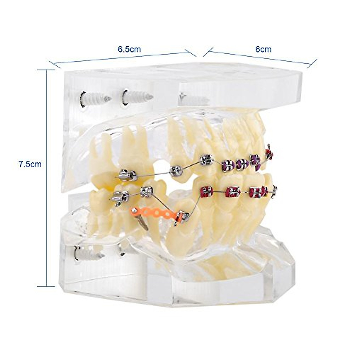 Teeth Educational Model Dental Treatment Malocclusion Study Demonstration Teeth Model with Wire Chain Orange