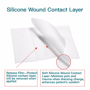 Dimora Silicone Wound Contact Layer, Non-adhering Dressing, Transparent Wound Dressing Pads, 3in x 4in (7.5cm x 10cm), 10 pcs