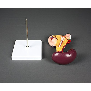 Vision Scientific VAD423-N Pancreas, Duodenum, & Spleen Model