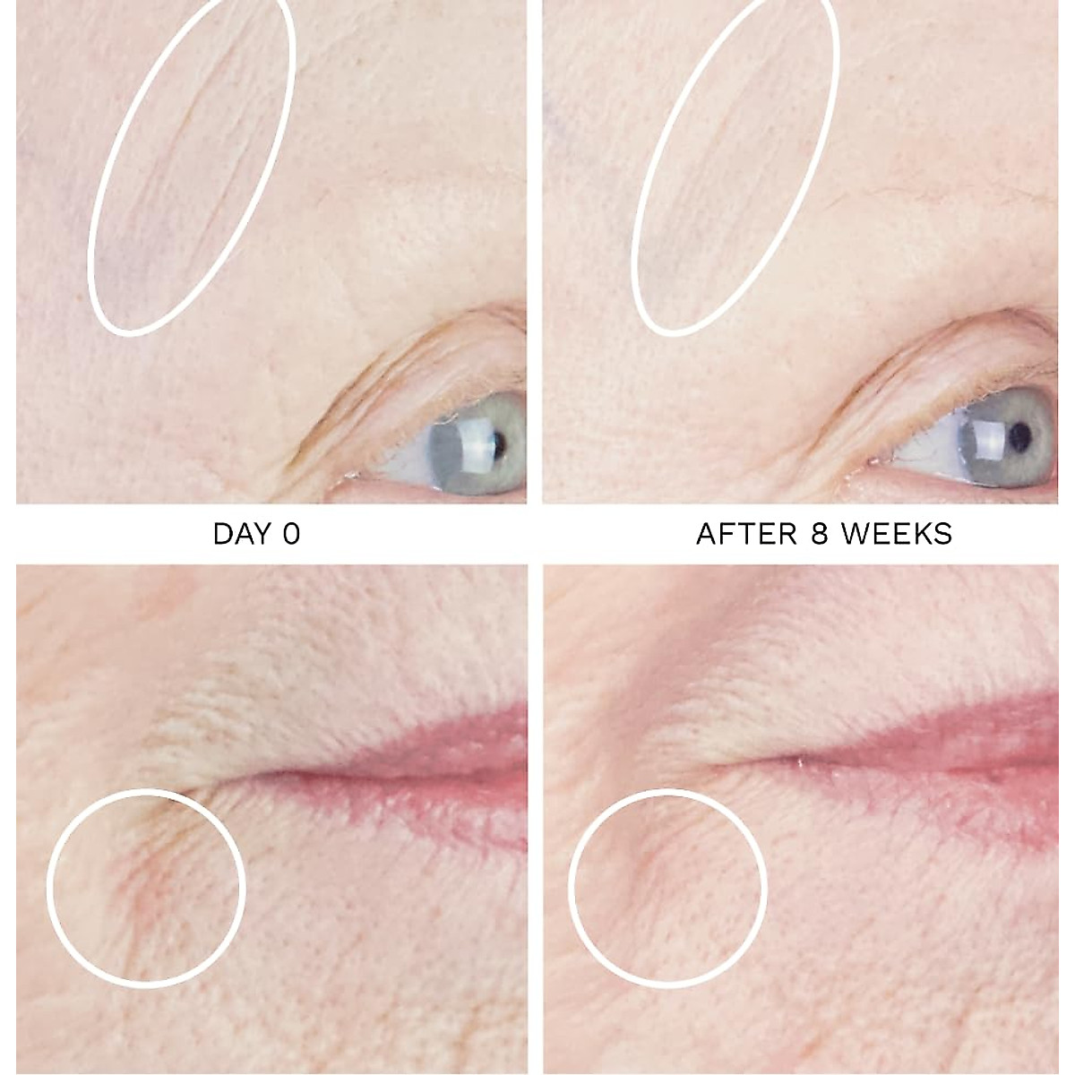 City Beauty UpLift Firming Serum - Face Serum - Lift & Tighten - Natural Sagging Skin Solution with Deep-Sea Extracts - Visibly Smooth Fine Lines & Wrinkles - - Cruelty-Free Skin Care