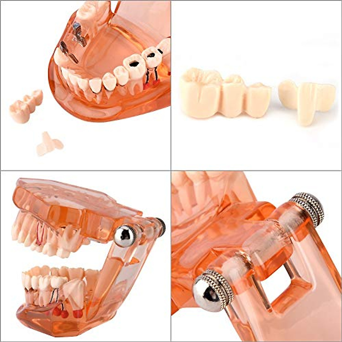 Maxmartt Teeth Model, Dental Demonstration Dental Implant Removable Study Model Teeth Teaching Model for Student Teacher, Orange