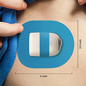 SIMPATCH – Omnipod Adhesive Patch with Strap (25-Pack) – Waterproof Adhesive, CGM Tape (Blue)