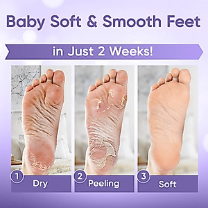 ﻿Foot Peel Mask (2 Pairs) - Foot Mask for Baby soft skin - Remove Dead Skin | Foot Spa Foot Care for women Peel Mask with Lavender and Aloe Vera Gel for Men and Women Feet Peeling Mask Exfoliating