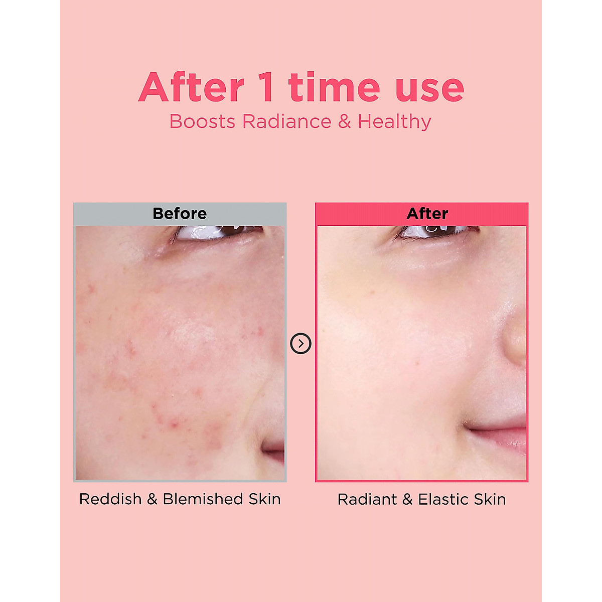 Easydew Re-DERMA Master Ampoule Award-Winning Anti Aging EGF Serum for Face/Neck/Eyes-14 Vials…