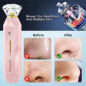 Blackhead Remover Pore Vacuum,Facial Sprayer Oxygen Hydrating,2 in 1 Multifunction Derma Blemish Removal Cleanser, Face Steamer Whitehead Acne Remover, Deeply Spots Cleaner Suction (Pink)