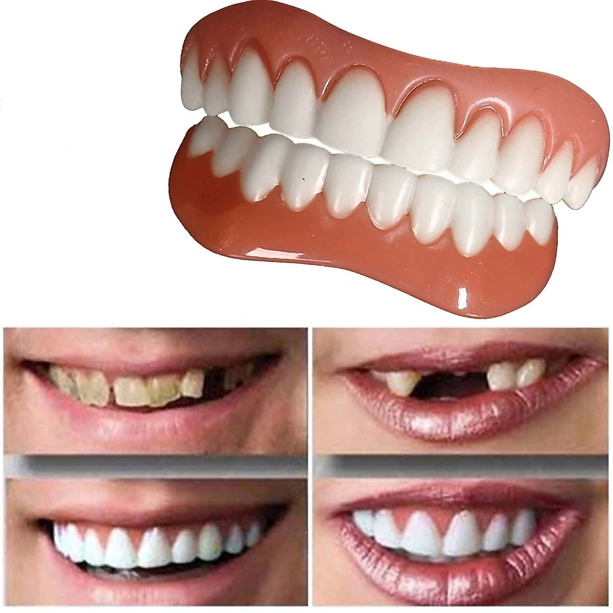 CHNLML Fake Teeth, Cosmetic Denture Veneers for Upper and Lower Jaw, Dental Veneers for Temporary Teeth Restoration, Nature and Comfortable, Protect Your Teeth - 2 Pcs