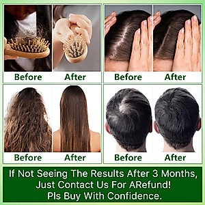 Rosemary Oil for Hair Growth,with Hair Serum for Hair Growth,Heat Protectant Spray,Biotin Argan Oil Hair Growth Products for Thinning Hair & Hair Loss Treatment,Birthday Gifts for Women Mom Her Men