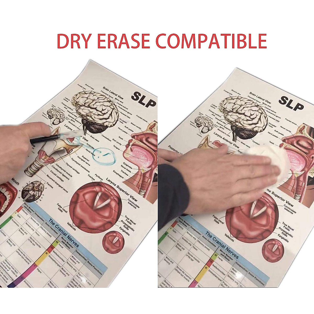 Larynx, Sound Production, Speech Articulation, Articulation LP 24x36 inch, 4 Poster Set