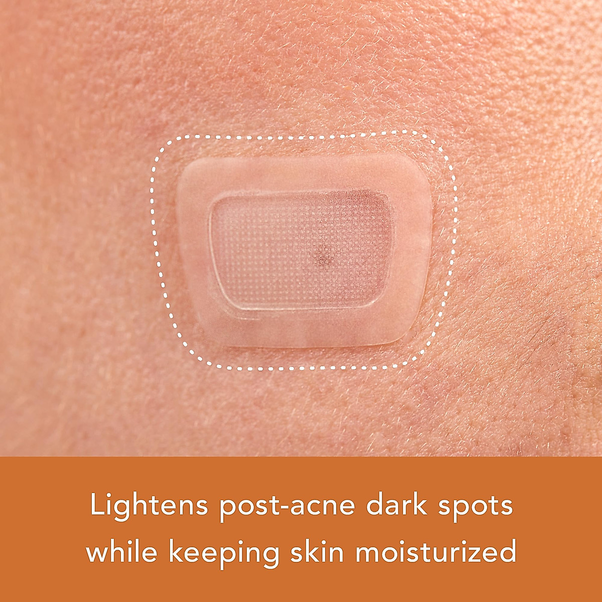 Rael Bundle - Microcrystal Dark Spot Cover (6 Count), Cica Spot Corrector Cream (.68oz, 20ml)