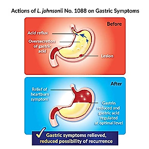 GASTRICELL - Eliminate H. Pylori, Relieve Acid Reflux and Heartburn, Regulate Gastric Acid - Targets The Root Cause of Recurring Gastric Problems, Natural Defence Against Gastric Distress -30 sachets