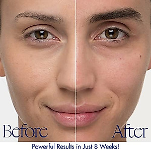 Obagi Nu-Cil Eyebrow Boosting Serum - Ultimate Eyebrow Growth Serum with Hyaluronic Acid - Dermatologist Approved Brow Serum for Thin, Patchy & Over-Tweezed Eyebrows - Fast Absorbing - 6ml