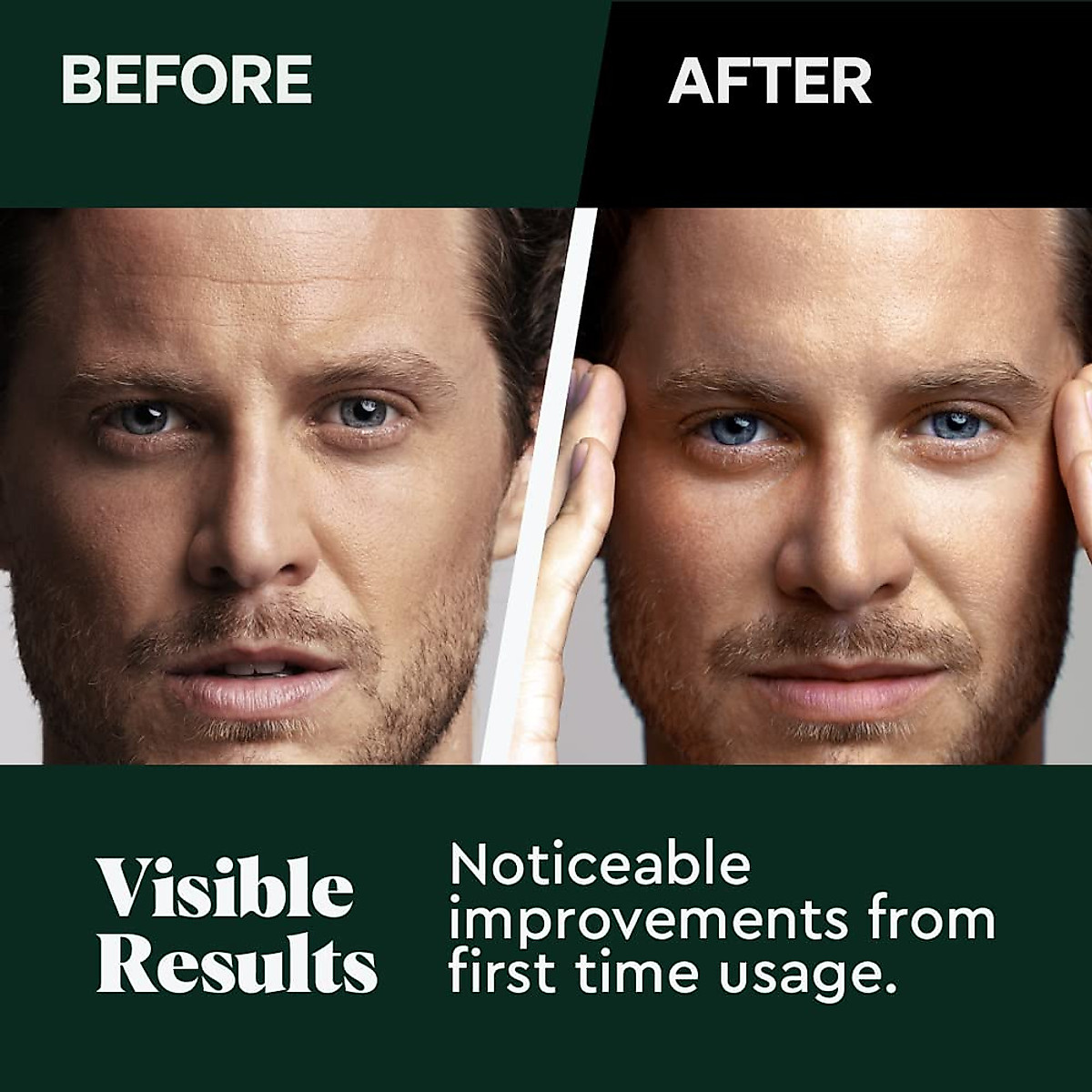 Wolf Project Men Skin Care Kit - Advanced Skin Care Set - Anti-Aging Face Moisturizer Gel Cream, Hydrating Charcoal Face Sheet Mask, Charcoal Face Cleanser - 3-Pack Mens Facial Care Kit