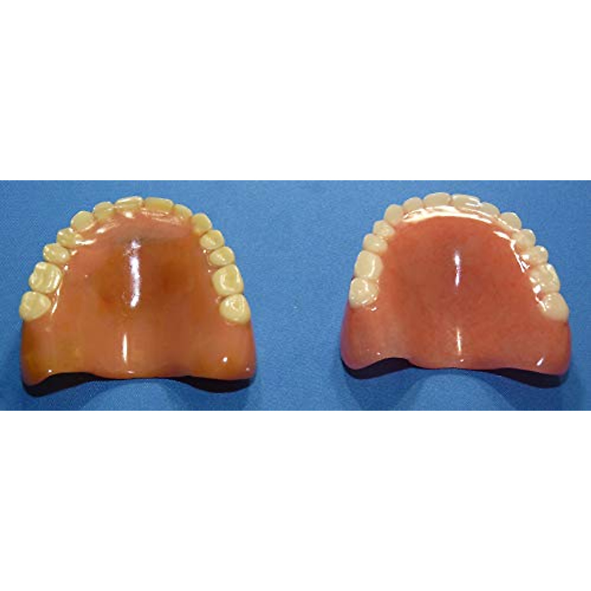 Denture Repair Lab - Duplicate Denture - Denture Clone - Denture Duplication - New Denture - Copy Denture - Spare Denture - Denture Clone - Denture Teeth Repair