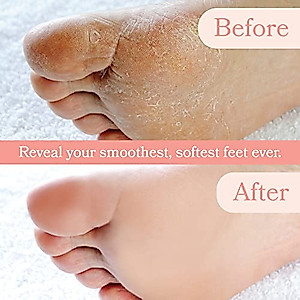Pedi Peach Precise Pedi Professional Pedicure Kit, Powerful Electric Callus & Corn Remover Foot Scraper, Foot Care Tool for Dead & Cracked Skin, Portable Electronic Foot File