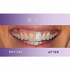 Snow The Magic Strips - Safe for Enamel Dissolving Teeth Whitening Strips - Mess-Free Portable Teeth Whitener for Oral Care with Lavender & Mint Flavor, Whitening Strips for Teeth, 1 Pack of 28 Strips