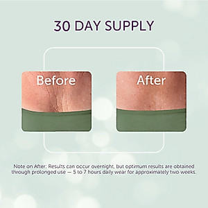 Silc Skin Decollette Pad - Medical-Grade Chest Wrinkle Pads, Smoothing Anti Wrinkle Chest Pads, Reusable Silicone Chest Wrinkle Patches, 30 Day Supply