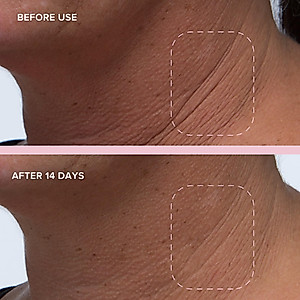 Alpyn PlantGenius Melt Moisturizer | Weightless Rich Cream Targeting Dry, Dehydrated Skin with Lasting Hydration and a Velvety, Makeup-Ready Finish | 1.7 oz / 50 ml