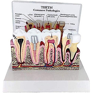 KEZaiZHe Anatomy Education Model - Teeth Cross-Section Model - Gums Model Anatomy Teeth Model Detachable Education Dental Model - for Study Display Teaching Medical Model