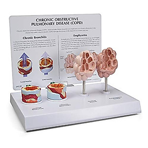 GPI Anatomicals - Anatomy Model of Human Respiratory System with Chronic Obstructive Pulmonary Disease (COPD), Bronchus and Alveoli Models for Anatomy and Physiology Education, Medical Study Supplies