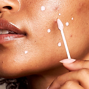 Kate Somerville EradiKate Acne Treatment - Clinically Formulated 10% Sulfur and BHA Spot Treatment – Clears Pimples, Cleans Pores and Prevents Breakouts, 1 Fl Oz