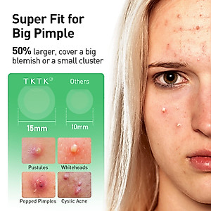 TKTK Pimple Patches, 15 mm Invisible Acne Patches for Face with Salicylic Acid, 0.01cm Extra Thin Outer Edge, Hydrocolloid Zit Patch for Pustule, Whitehead, Cystic Acne Spot, 48 Count