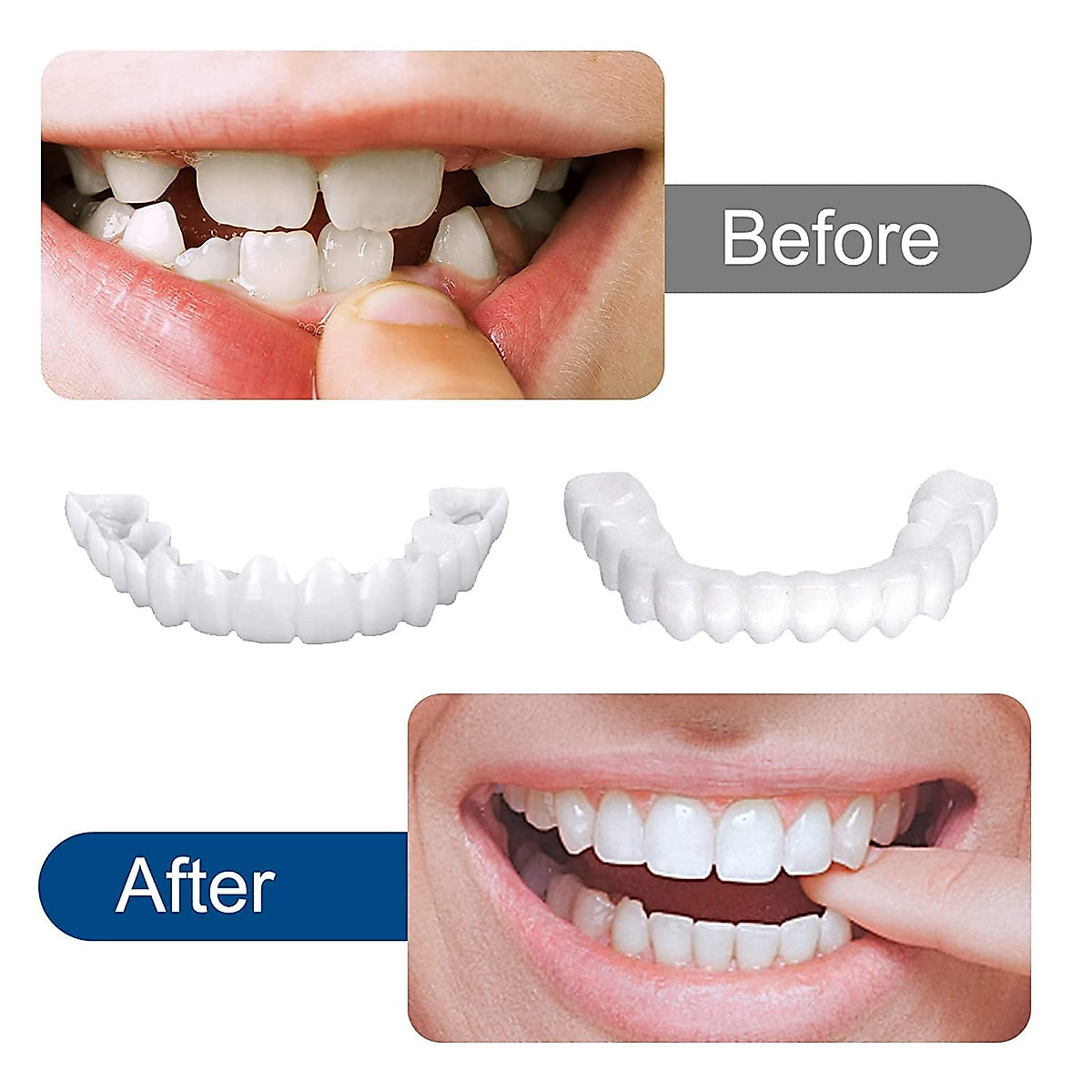 Tooth Repair, Cover The Imperfect Teeth,Fix Your Smile at Home Within Minutes!,Upper and Lower Whitening Teeth Sets2pcs