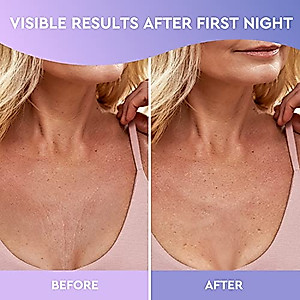 CLEVERFY Silicone Chest Wrinkle Pads Sleeping Reusable (3 Pack T-shape) - Decollete Anti Wrinkle Chest Pads - Silicone Patches for Wrinkles - Anti Wrinkle Patches for Chest Wrinkle Prevention