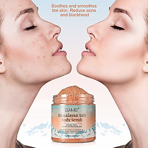 Moulis Himalayan Salt Body Scrub Natural Exfoliating Salt Scrub for Acne, Cellulite, Deep Cleansing, Scars, Wrinkles, Exfoliate and Moisturize Skin Infused with Collagen and Stem Cell