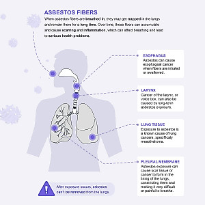 Asbestos Test Kit - Includes Asbestos Test Kit Lab Analysis, Pre-Paid Return Mailer, Fast Emailed Asbestos Test Results in 1 Week (5 Business Days) and Expert Asbestos Test Kit Consultation