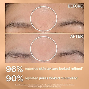 StriVectin Advanced Resurfacing Daily Reveal Exfoliating Face Pads, Visibly Smooths and Brightens Skin, Reduces Blackheads 60 ct