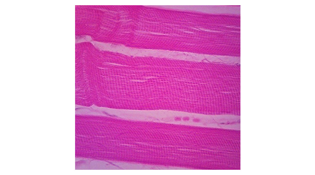 Adult Human Skeletal Muscle Slide - High-Quality Microscopy Sample
