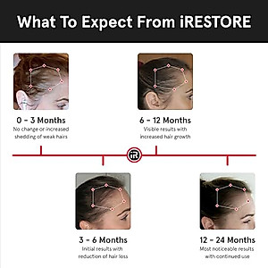 iRestore Essential Laser Hair Growth System + Rechargeable Battery Pack - FDA Cleared Hair Growth for Men & Hair Loss Treatments for Women with Thinning Hair, Hair Regrowth for Women