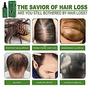 Anti-Hair Loss Spray Hair Nutrient Solution, 120 ml