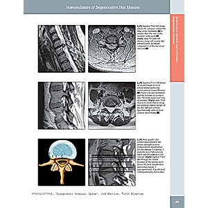Diagnostic Imaging: Spine