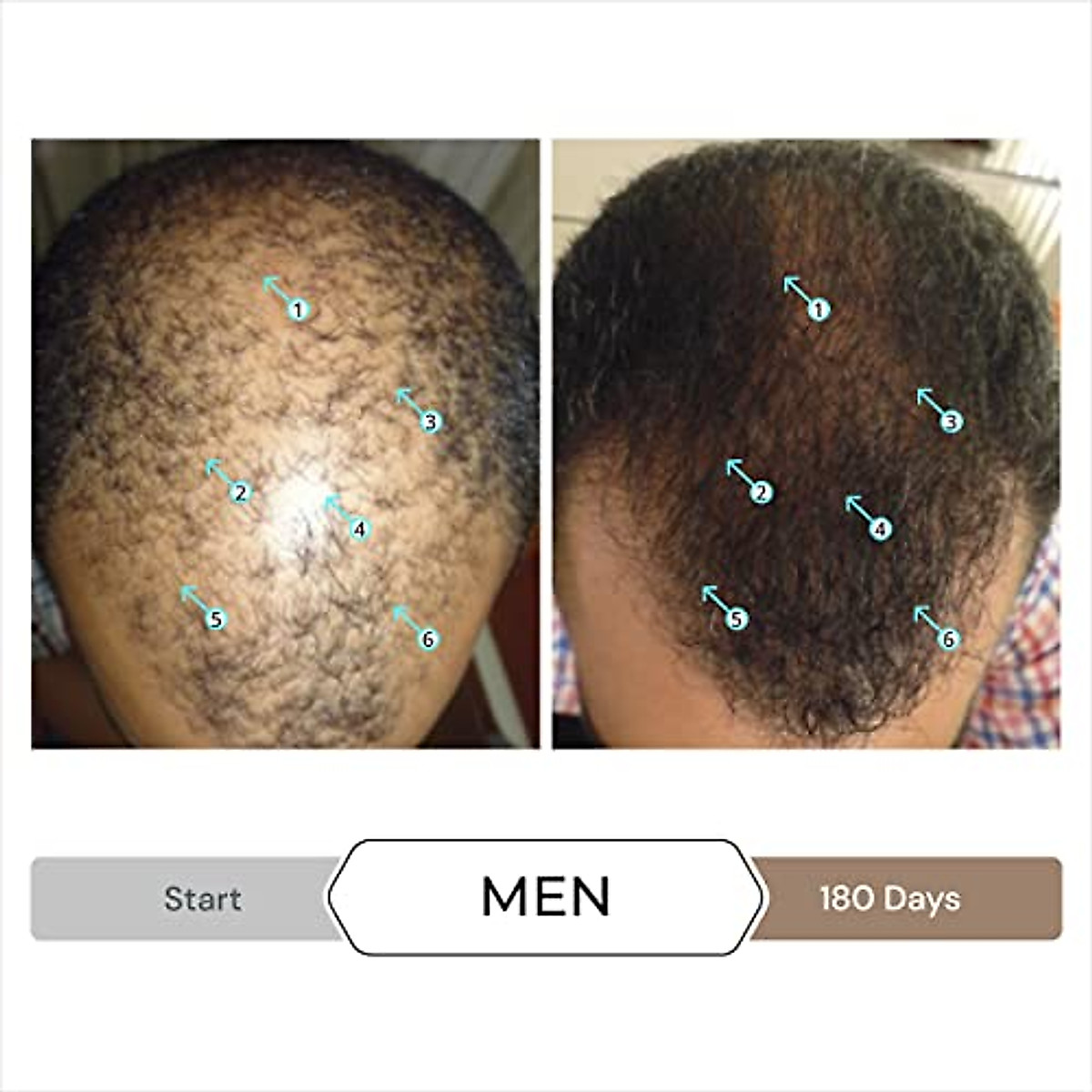 Spectral.DNC-N Leave In Serum to Support Hair Growth by DS Laboratories - Minoxidil Alternative for Men and Women, Experience Fuller, Thicker Hair, Water Based Formula 90 Day Supply (2 fl oz)