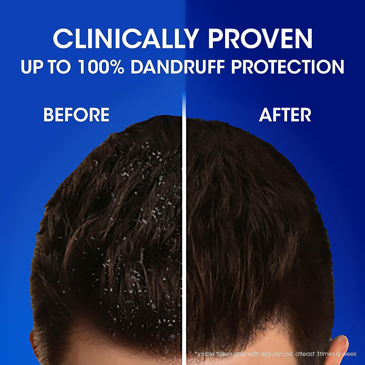Head &amp; Shoulders Anti Dandruff Cool Menthol Shampoo, 340ml