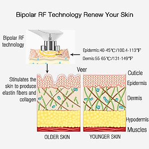 Radio Frequency Machine Professional 25 Watts Face RF Increase Collagen Firm Skin Wrinkle Reducing