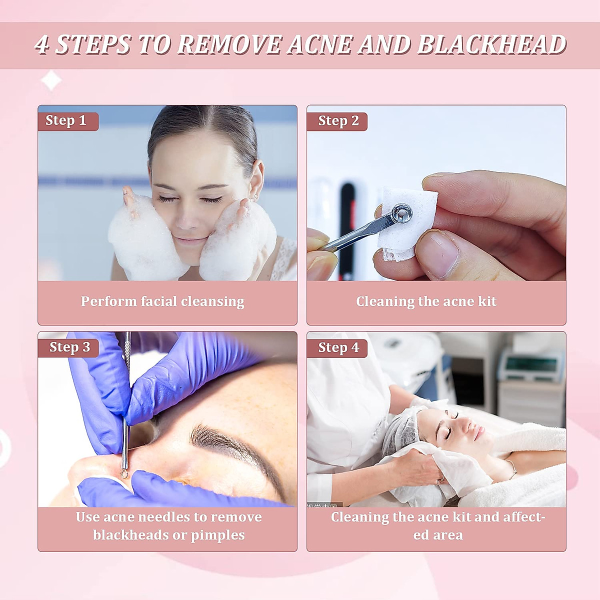 4PCS Blackhead Acne Removal Extractor, Curved Blackhead Tweezers Kit, Professional Stainless Pimple Acne Blemish Removal Tools Kit with Storage Box