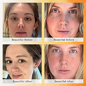 Scentuals Vitamin C Serum for Face, Brightening Serum, Reduce Look of Fine Lines & Wrinkles, Water-Based 2 fl.oz|60 ml