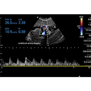 Philips Lumify C5-2 Curved Array Transducer, Portable Ultrasound Solution