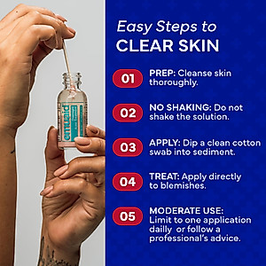 EMUAID Overnight Acne Treatment, Gentle Fast-Acting Solution with Salicylic Acid for Adults and Teens, Clears Stubborn Pimples, Cystic Acne, Blackheads, Rosacea, and Hormonal Breakouts, 1oz