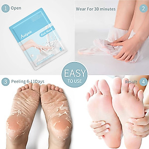 Foot Masks-5 Pack,Natural Foot Care Exfoliating Treatment Repairs Cracked Heels,Peeling Away Calluses and Dead Skin Cells,Make Your Feet Baby Soft & Get a Smooth Skin -For Men Women（Milk &Avocado）