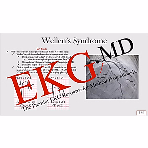 Ultimate EKG Breakdown - The EKG Guy