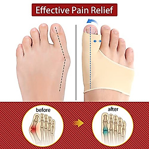 HFXBearArmor Bunion Splint 2PCS, Bunion Corrector for Men and Women Bunion Relief in Hallux Valgus, Toe Spacers for Feet, Hammer Toe Straightener Bunion Pads Day and Night Use - S