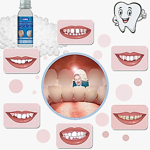 Fake Teeth Repair Kit, Provisional Fake Teeth Replacement Kit for Provisional Restoration 【100% New 30Ml -1 Bottle】
